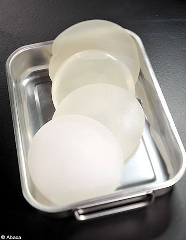 PIP : les prothèses mammaires remplacées gratuitement ? - Elle